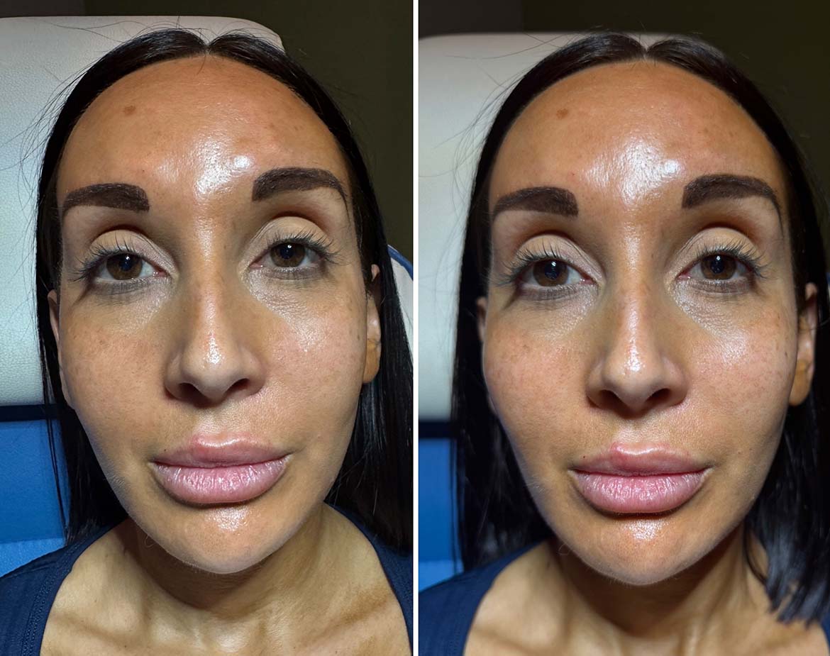 Jennifer Demers in Parrish , FL | Elite Medical Spa